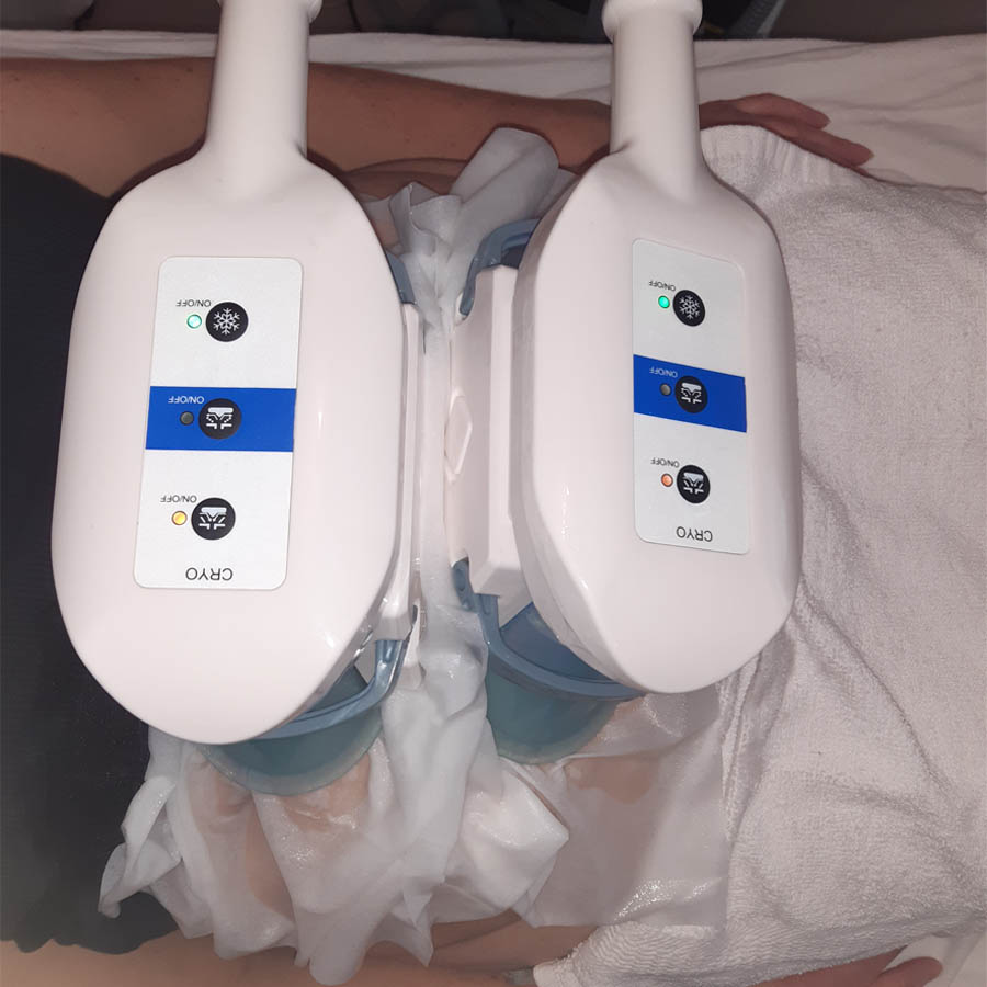 Loeline, votre institut de cryolipolyse à Saintes